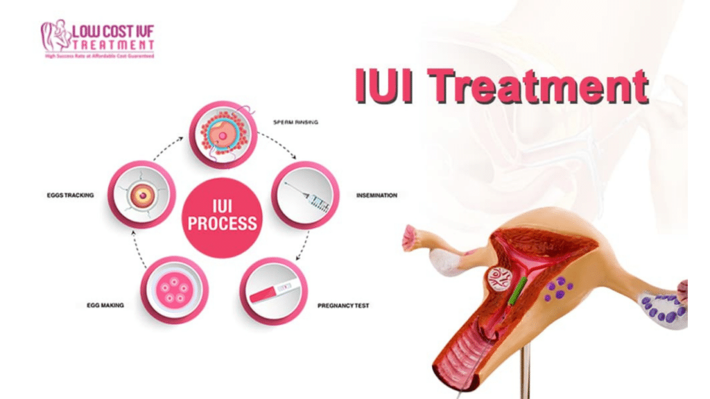 Affordable IUI Treatment in Bangalore | Low Cost IVF Treatment